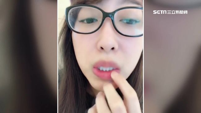 愛美砸12萬做牙雕 竟成暴牙易卡黑垢！正妹小模崩壞GG | 生活 | 三立新聞網 SETN.COM