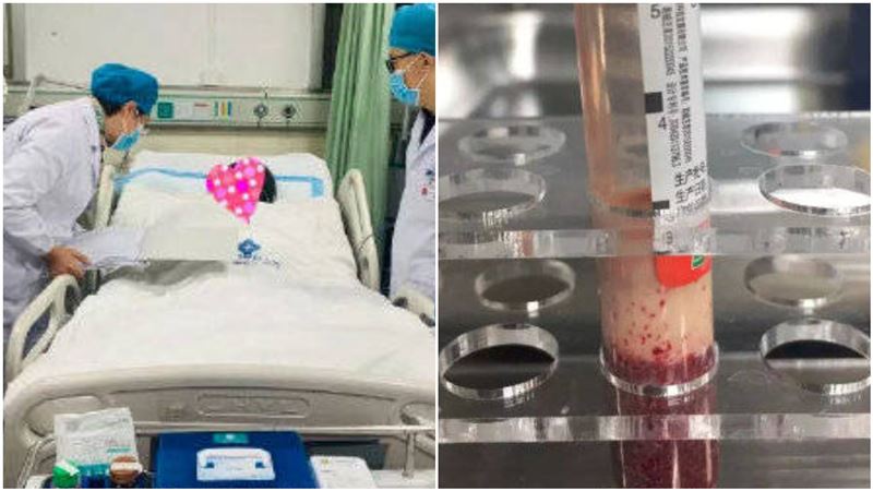 每天來一杯！22歲女師連血也變「奶茶色」昏倒慘送ICU | 祝你健康 | 三立新聞網 HEALTH.SETN.COM