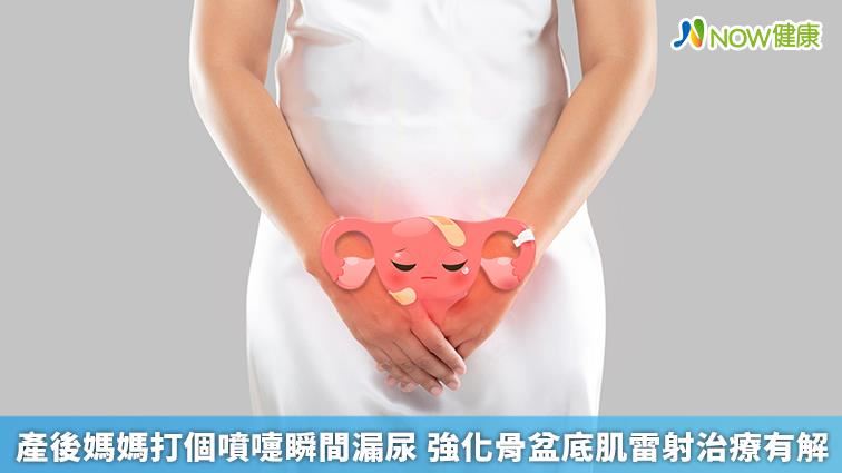 NOW健康／產後媽媽打個噴嚏瞬間漏尿 骨盆底肌雷射有解 | 專欄 | 三立新聞網 SETN.COM