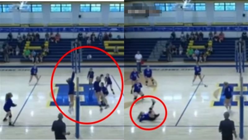 男跨女排球員暴力扣殺「112公里」 她用臉接當場腦震盪 | 國際 | 三立新聞網 SETN.COM