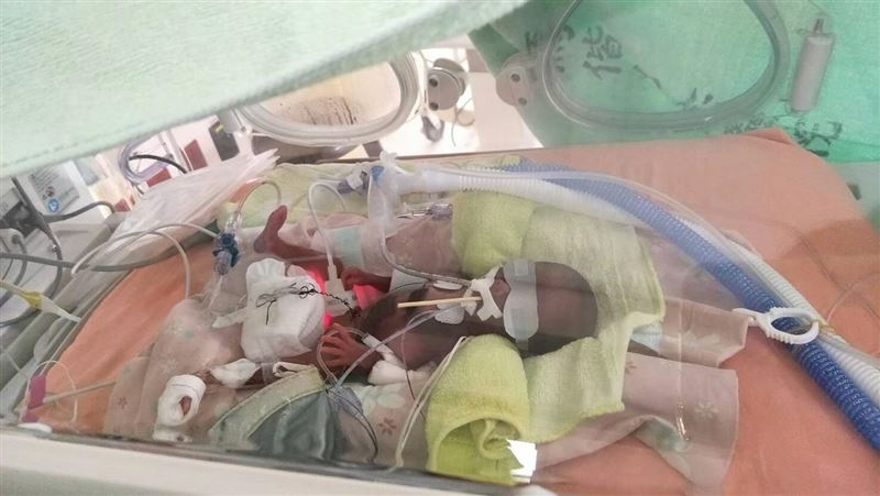 比1瓶礦泉水輕！早產兒「閃閃」出生僅550克！今甩呼吸器「回娘家」跑跳 | 生活 | 三立新聞網 SETN.COM