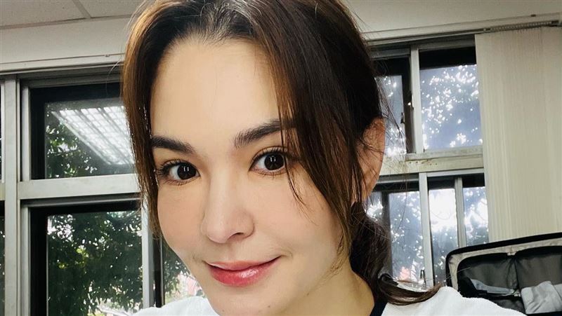 混血女星嚴重意外！睡一覺醒來「手臂遍布ok蹦」 驚人傷勢照惹心疼 | 娛樂星聞