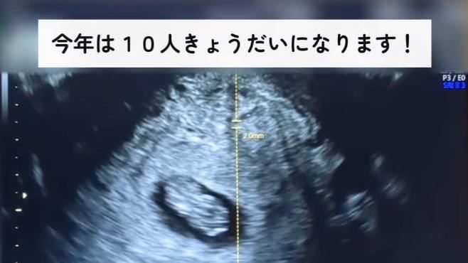 生7男2女！39歲「9寶媽網紅」曬超狂超音波：10寶報到 網驚呆狂賀 | 國際 | 三立新聞網 SETN.COM