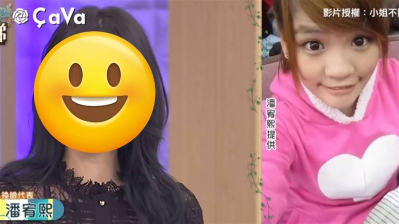 32歲女砸400萬整形「全臉大改造」對比畫面流出 老公驚人反應曝 | 娛樂星聞 | 三立新聞網 SETN.COM