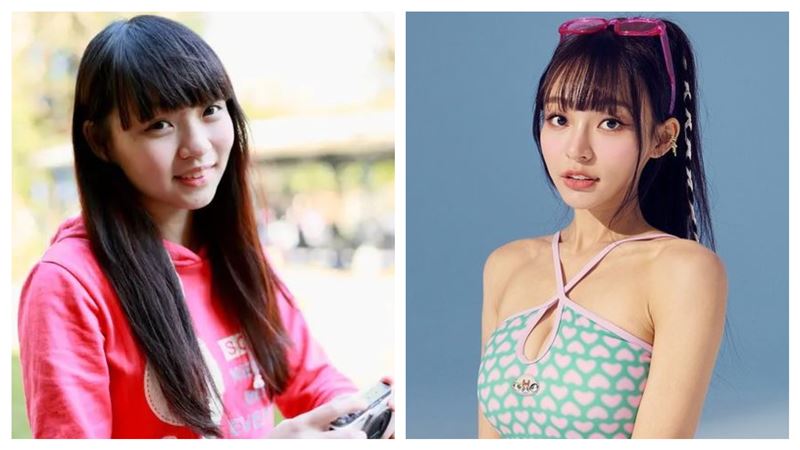 林襄飛韓國做醫美！嘴打玻尿酸「1疏忽」 醒來GG了：被自己幽默到 | 娛樂星聞