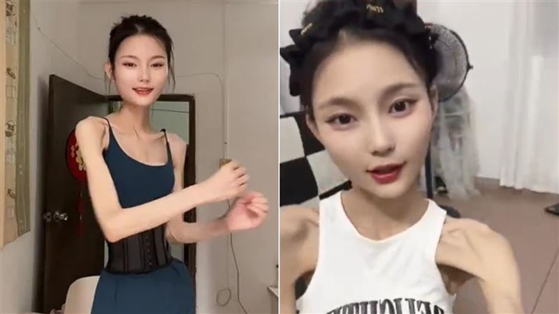 160公分「體重僅25公斤」 妹子嫌不夠瘦：還要繼續減肥 | 兩岸(大陸) | 三立新聞網 SETN.COM