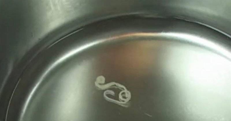 MRI檢查以為是腦腫瘤 患者莫名頭痛、抽搐竟是「寄生蟲」釀禍 | 國際 | 三立新聞網 SETN.COM