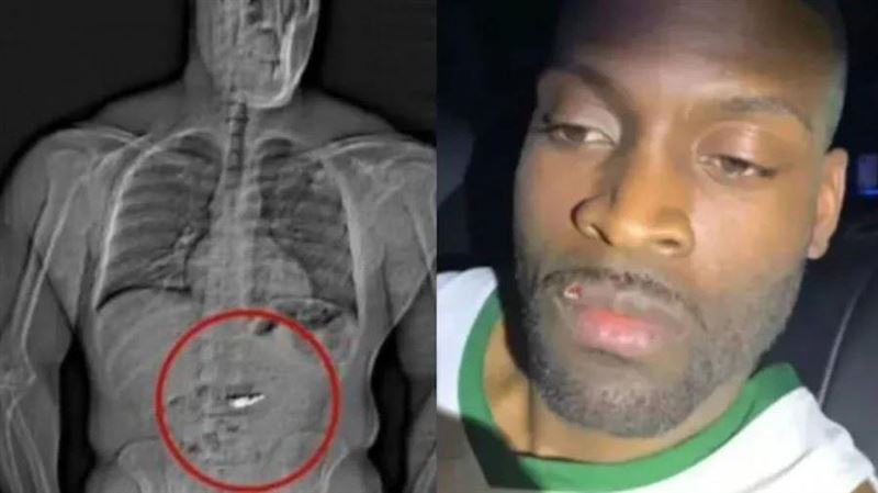 胃在發光！美男搶劫「2400萬珠寶全吞了」天真問：肚有東西會被起訴嗎？ | 國際 | 三立新聞網 SETN.COM