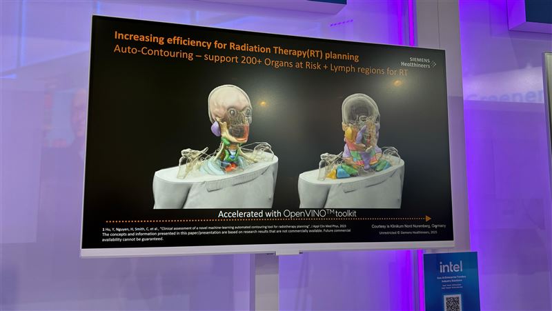 醫師福音！英特爾COMPUTEX大秀AI肌肉 CPU加速醫療影像生成 | 財經 | 三立新聞網 SETN.COM