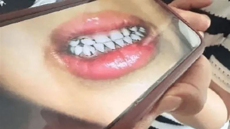 中國233名幼童鉛中毒「齒黑、智商退」 全因幼兒園省錢餵顏料 | 兩岸(大陸) | 三立新聞網 SETN.COM